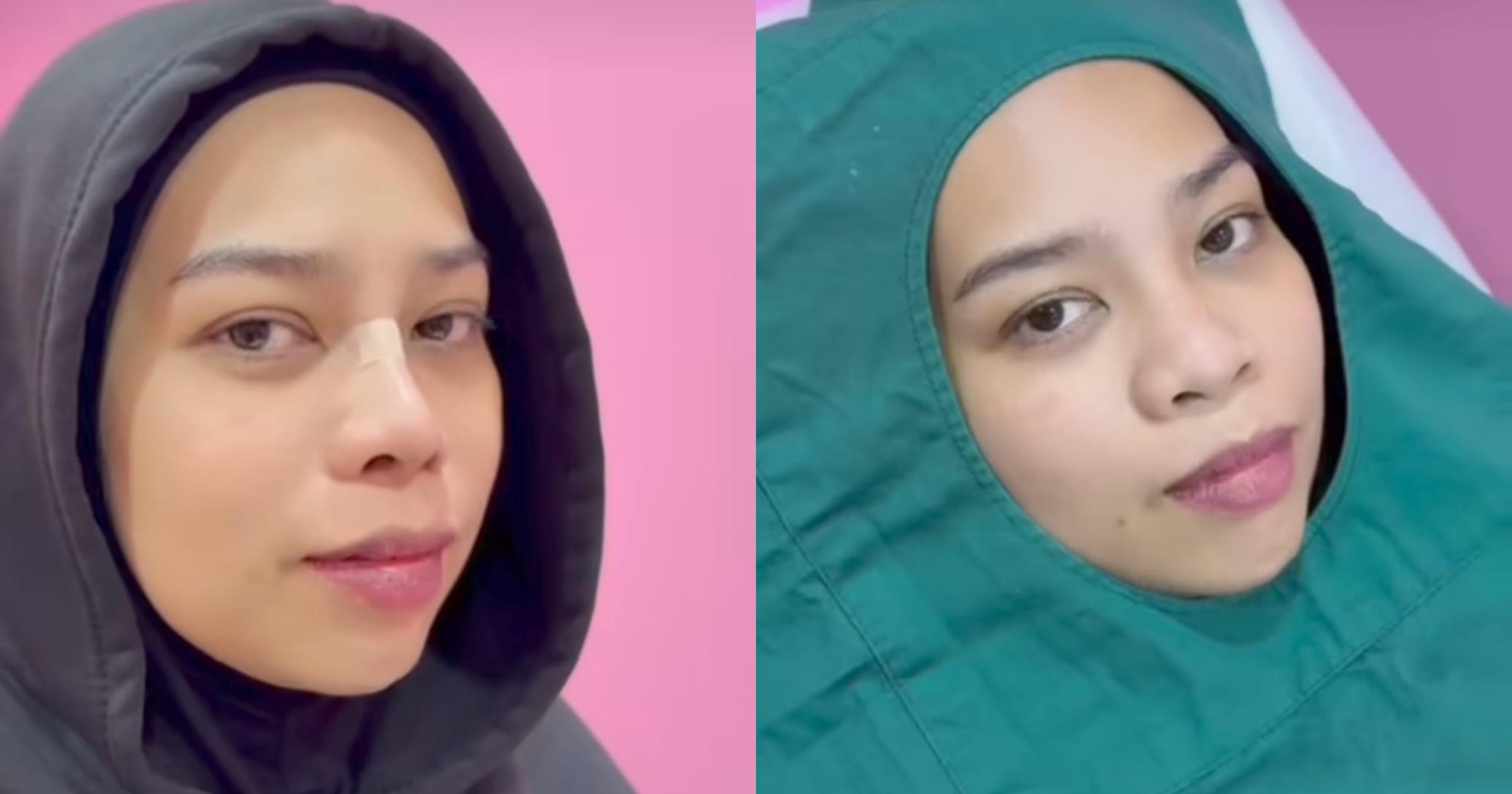 Masalah sinus, hidung Ayu Damit mancung lepas rawat